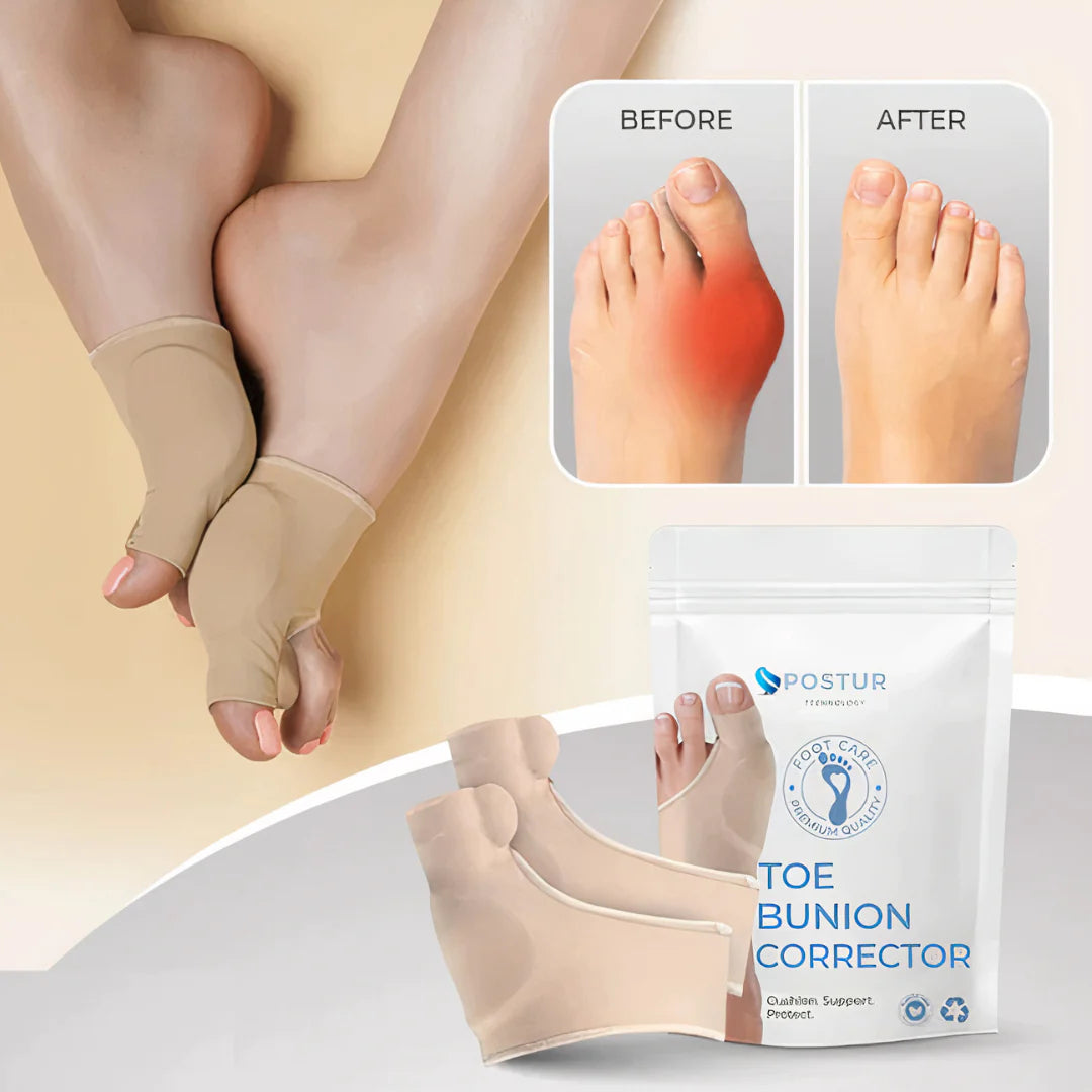 BunionCare™ - Orthopaedic Hallux Valgus Corrector – quanoloshop